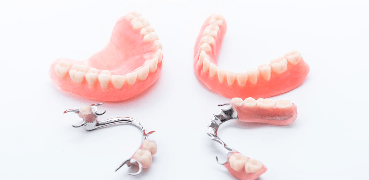 Les prothèses amovibles | Cabinet Top Dent à Dole | Dr Radu Bulz